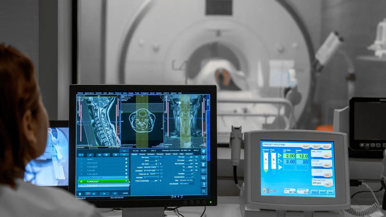 DAMO Academy’s AI-based Screening Achieves Breakthrough in Early Detection of Pancreatic Cancer